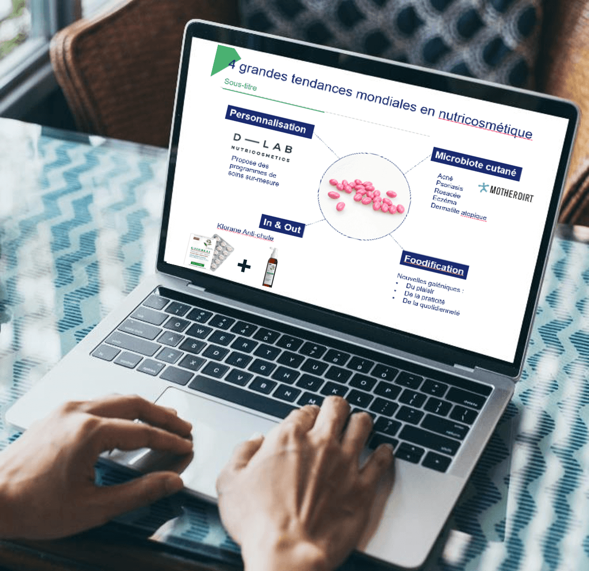 Seventure - Cibles d'investissement : les identifier